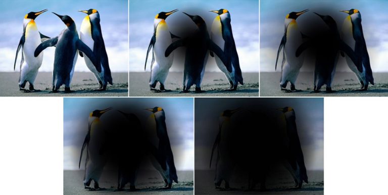 Age Related Macular Degeneration (AMD) | Insight Eye Clinic